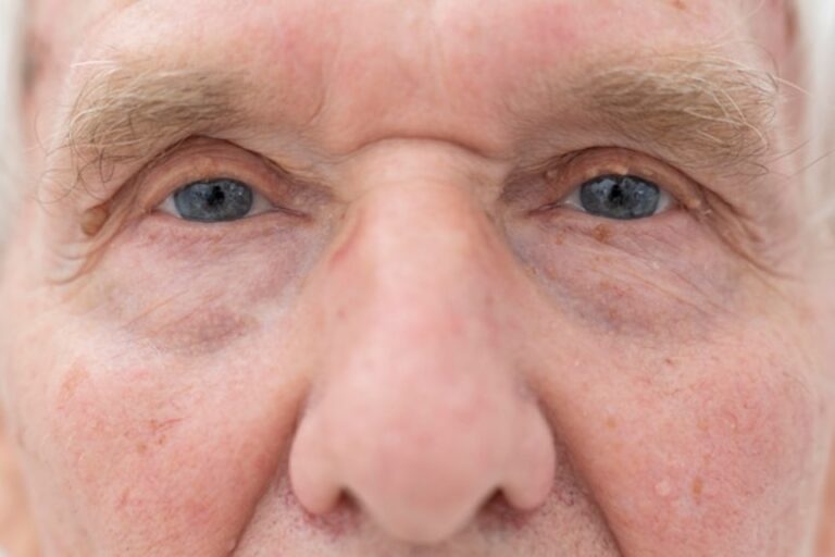 4 Ways to Prevent Vision Loss from Glaucoma - The Glaucoma Foundation